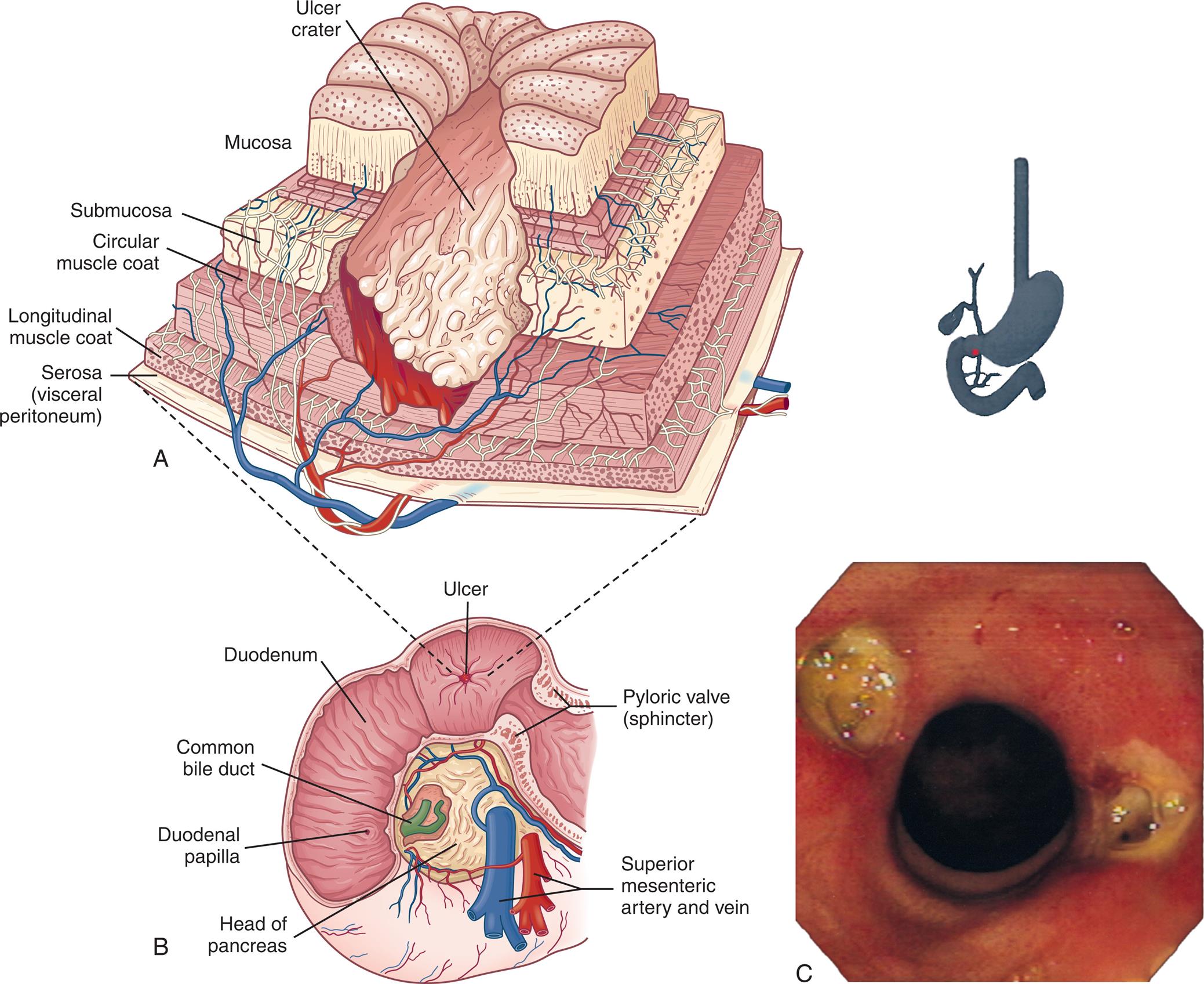 41: Alterations of Digestive Function