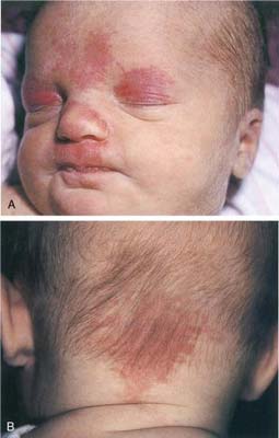 Physiologic and behavioral adaptations of the newborn