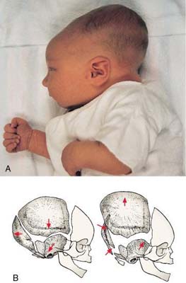 Physiologic and behavioral adaptations of the newborn