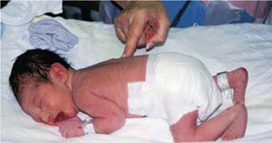 Physiologic and behavioral adaptations of the newborn