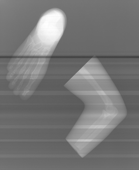 Digital Radiography and Pacs