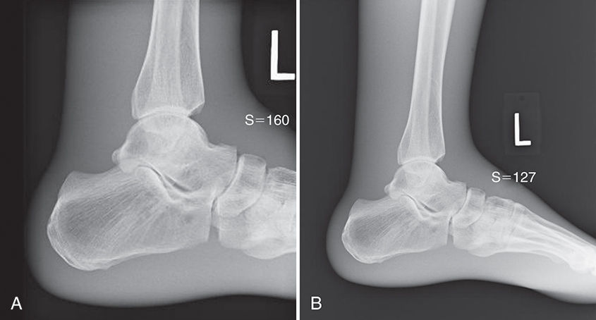 Digital Radiography and Pacs