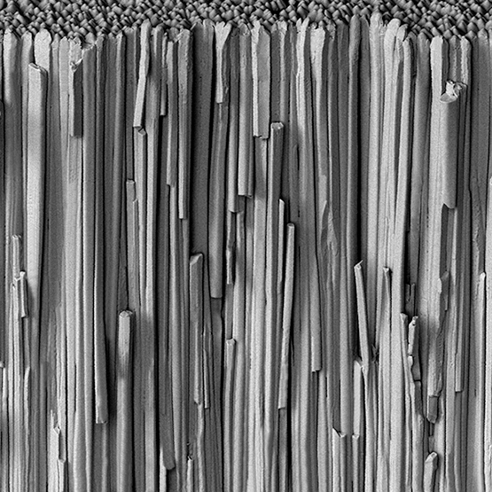 Digital Radiography and Pacs