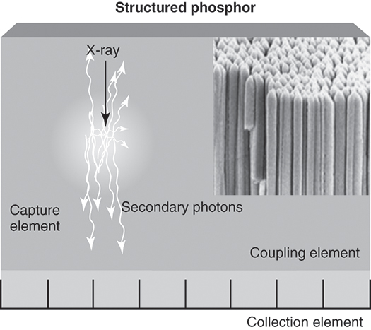 Digital Radiography and Pacs