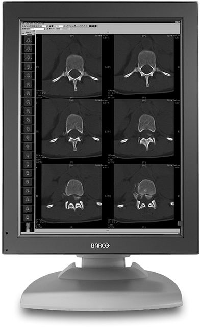 Digital Radiography and Pacs