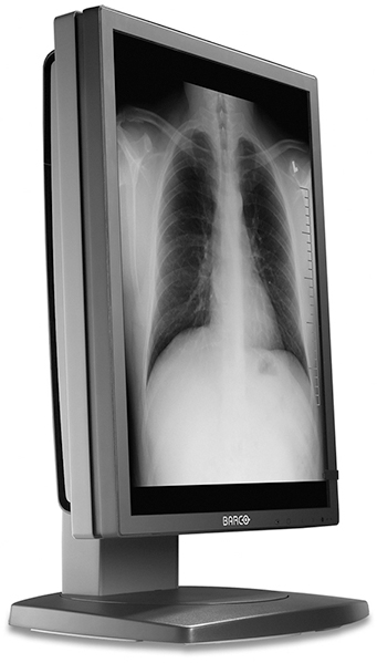 Digital Radiography and Pacs