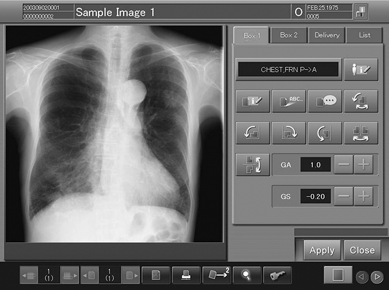 Digital Radiography and Pacs