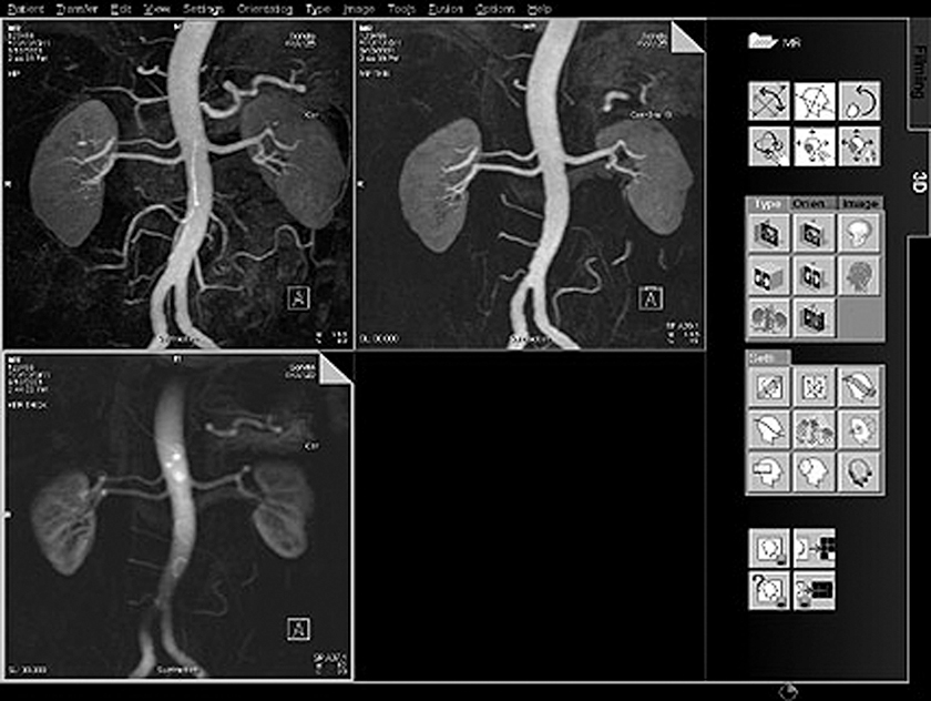 Digital Radiography and Pacs