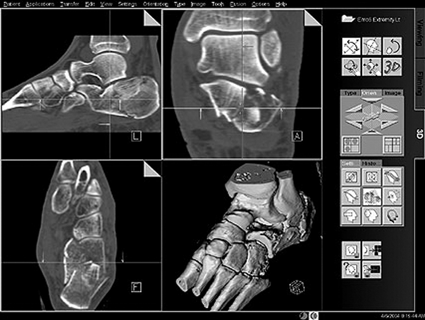 Digital Radiography and Pacs