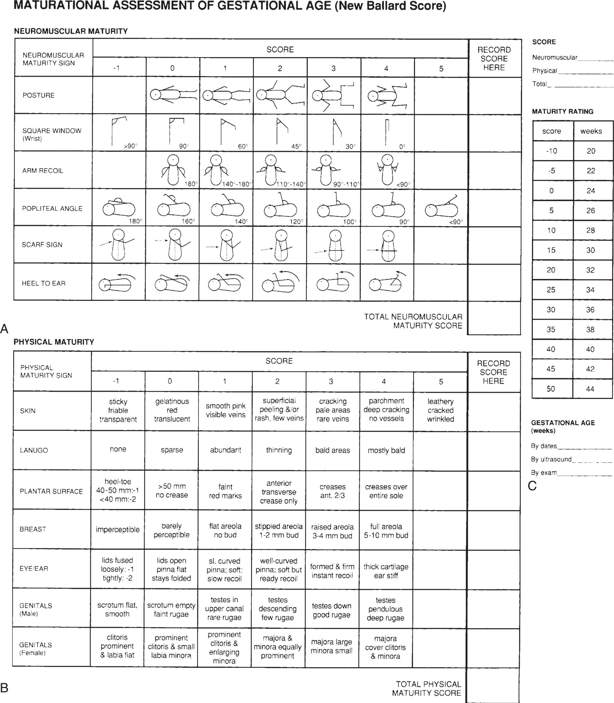 13: Preterm and Postterm Newborns