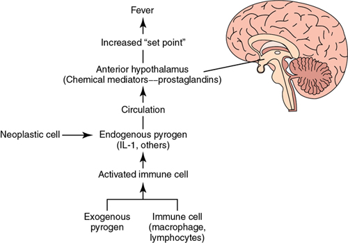Hyperthermia and fever