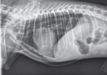 Subcutaneous emphysema