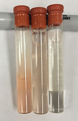 Cerebrospinal fluid sampling and interpretation