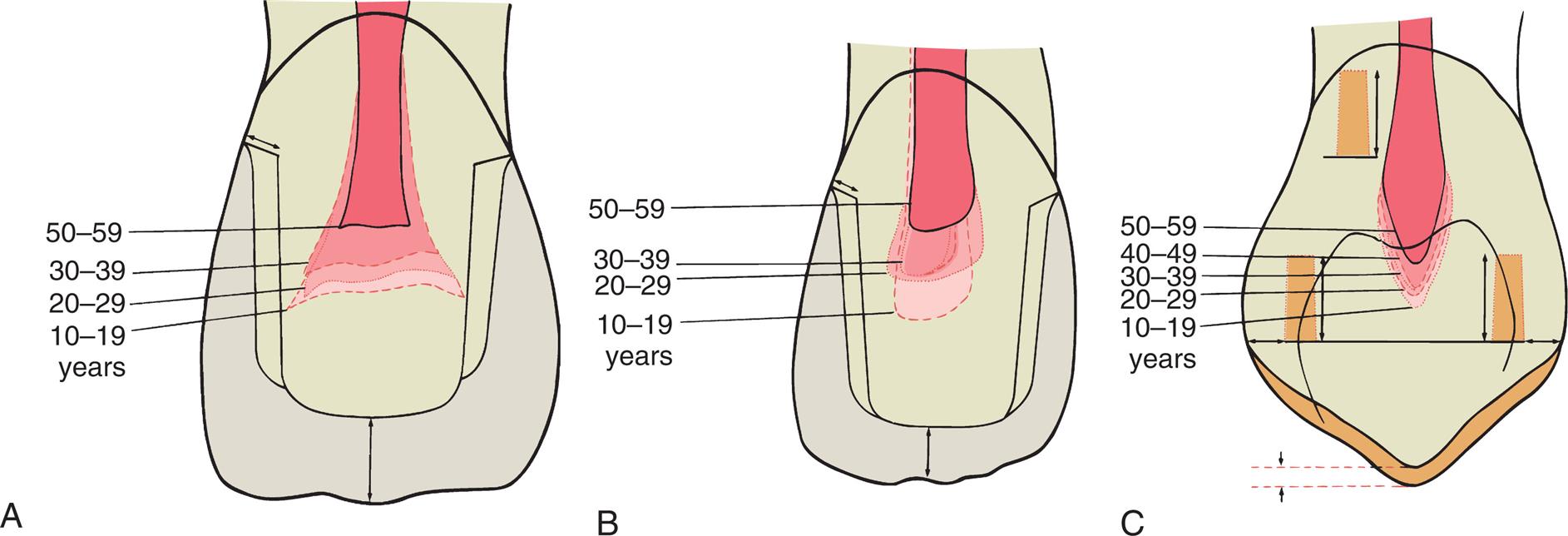 7: Principles of Tooth Preparation