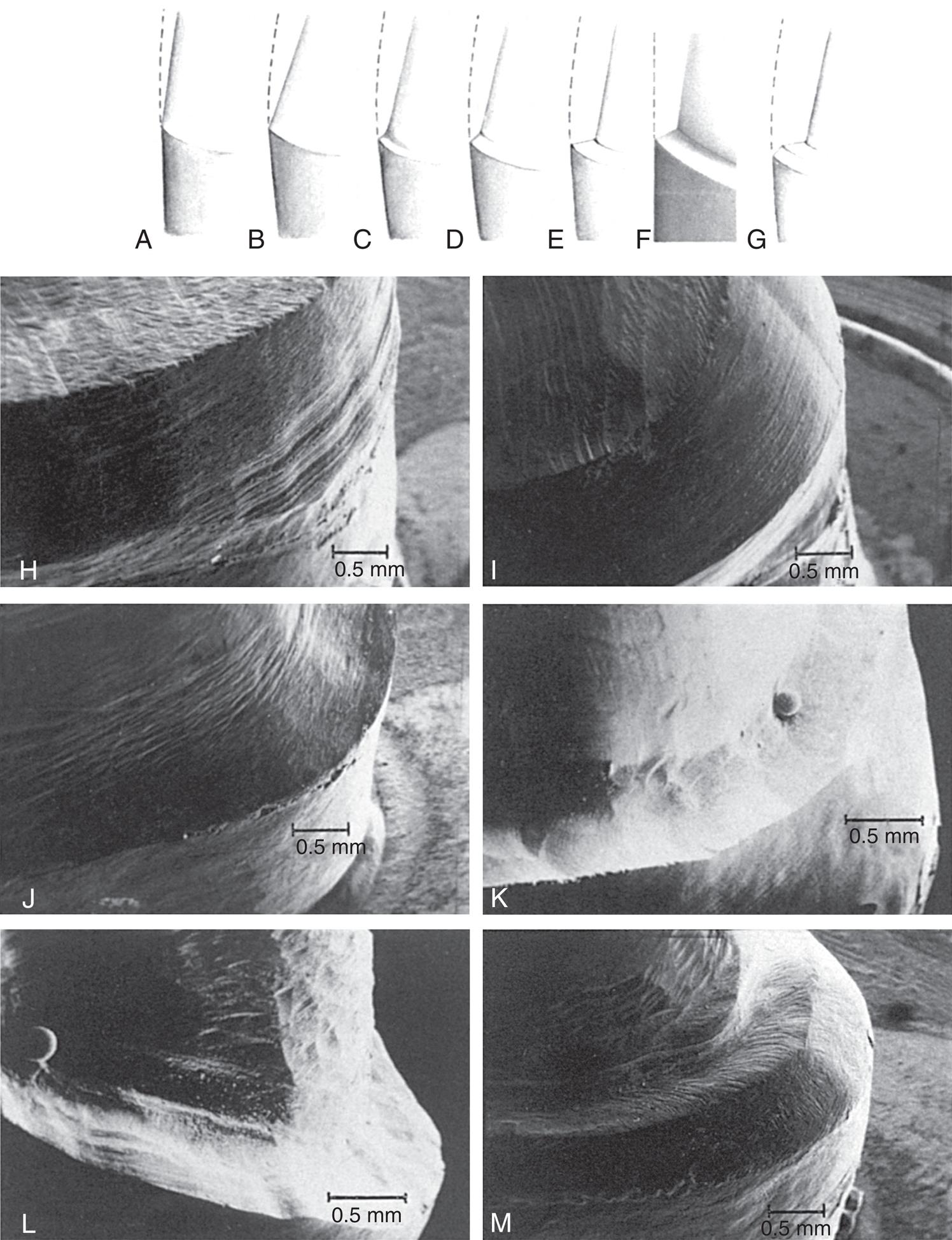 7: Principles of Tooth Preparation