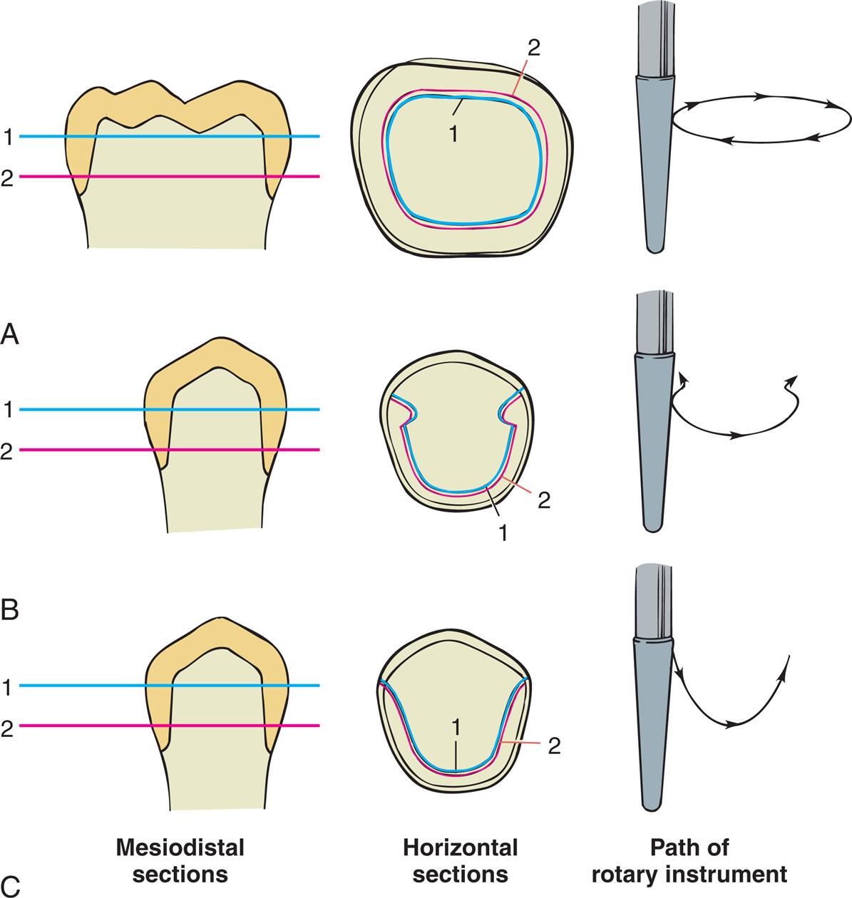 7: Principles of Tooth Preparation