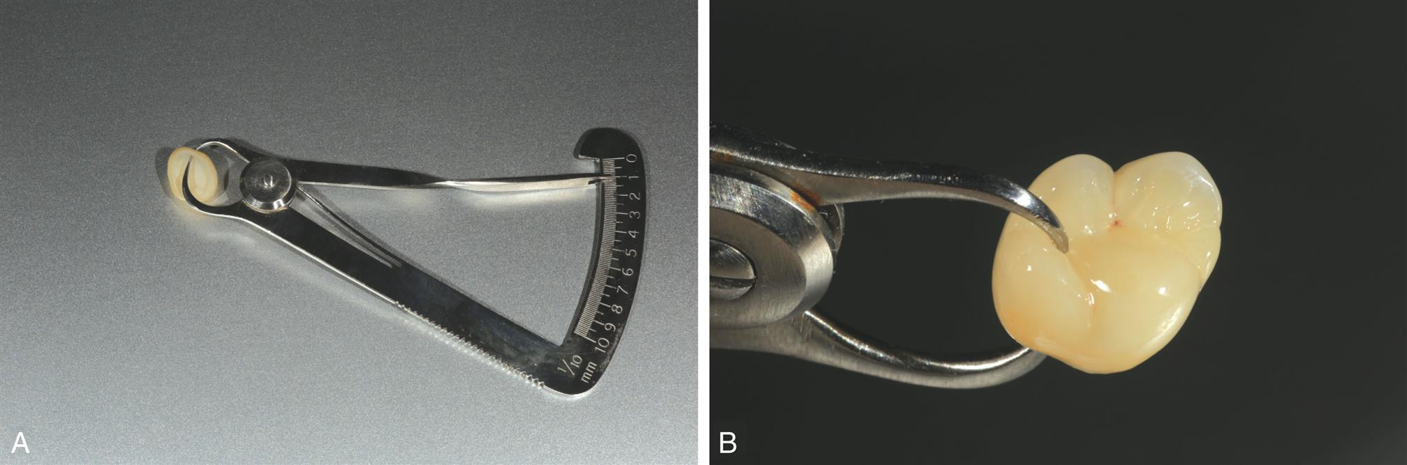7: Principles of Tooth Preparation