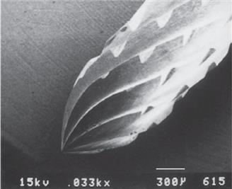 7: Principles of Tooth Preparation