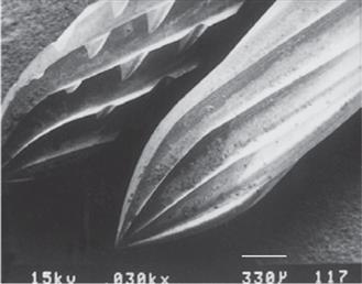 7: Principles of Tooth Preparation