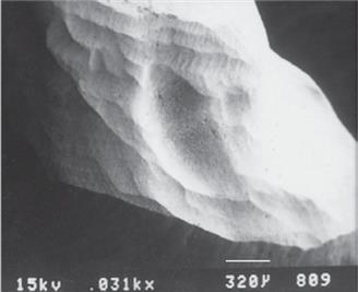 7: Principles of Tooth Preparation