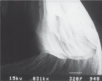 7: Principles of Tooth Preparation