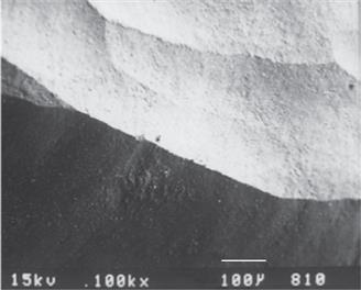 7: Principles of Tooth Preparation