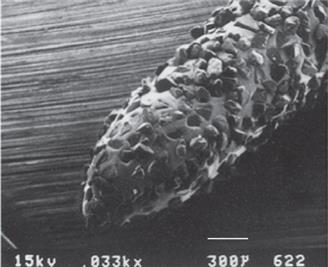 7: Principles of Tooth Preparation