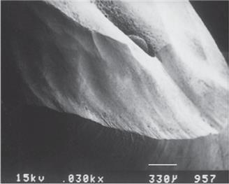 7: Principles of Tooth Preparation