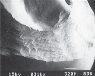 7: Principles of Tooth Preparation