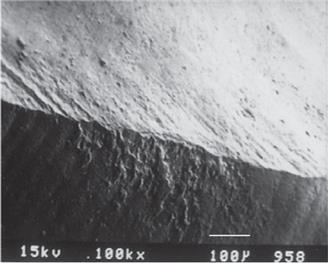 7: Principles of Tooth Preparation