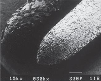 7: Principles of Tooth Preparation