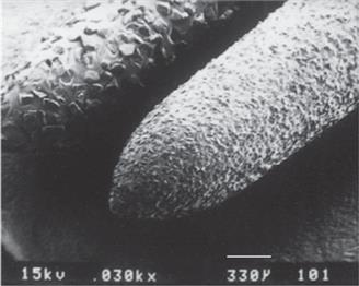 7: Principles of Tooth Preparation