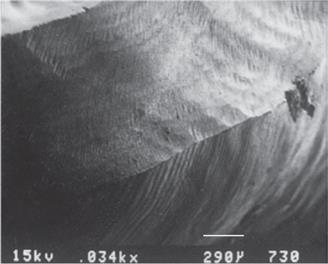 7: Principles of Tooth Preparation