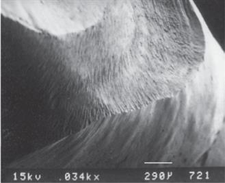 7: Principles of Tooth Preparation