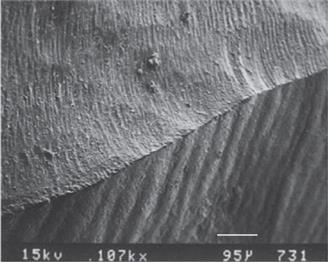 7: Principles of Tooth Preparation