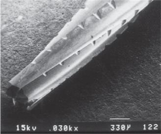 7: Principles of Tooth Preparation