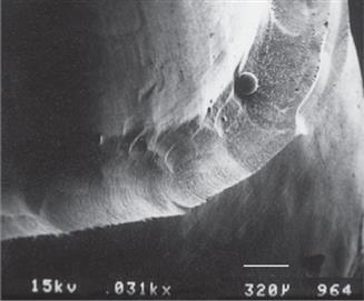 7: Principles of Tooth Preparation