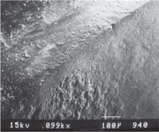 7: Principles of Tooth Preparation