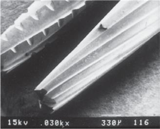 7: Principles of Tooth Preparation