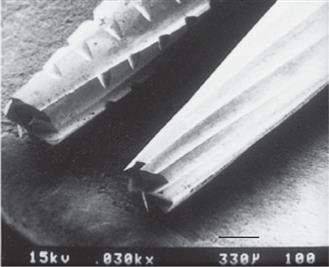7: Principles of Tooth Preparation