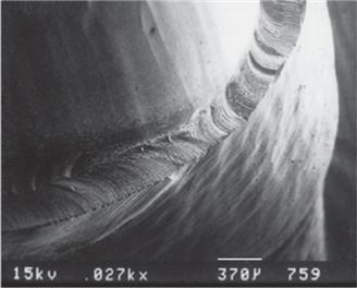 7: Principles of Tooth Preparation