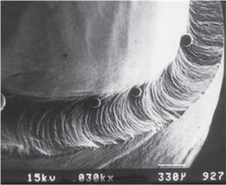 7: Principles of Tooth Preparation