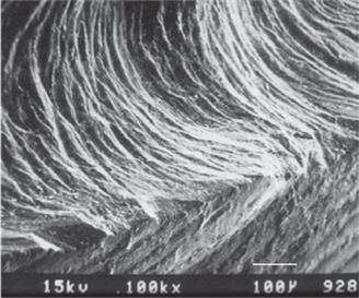 7: Principles of Tooth Preparation