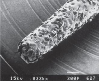 7: Principles of Tooth Preparation