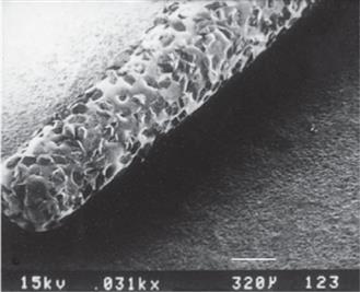 7: Principles of Tooth Preparation