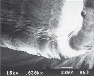 7: Principles of Tooth Preparation