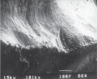 7: Principles of Tooth Preparation