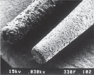 7: Principles of Tooth Preparation
