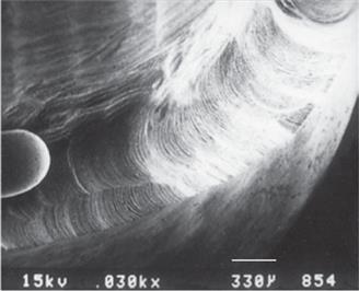 7: Principles of Tooth Preparation