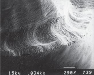 7: Principles of Tooth Preparation